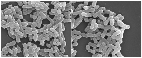 Latest Trends in Industrial Vinegar Production and the Role of Acetic ...