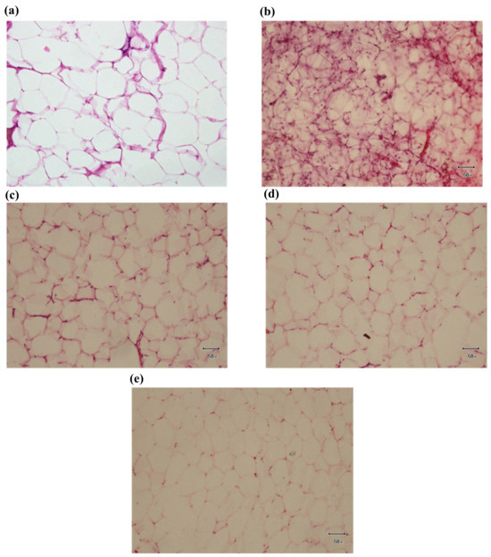 Comparison of Efficacy of Fermented Garlic and Orlistat (Lipase ...