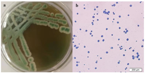 Screening of a Saccharomyces cerevisiae Strain with High 3-Methylthio-1 ...
