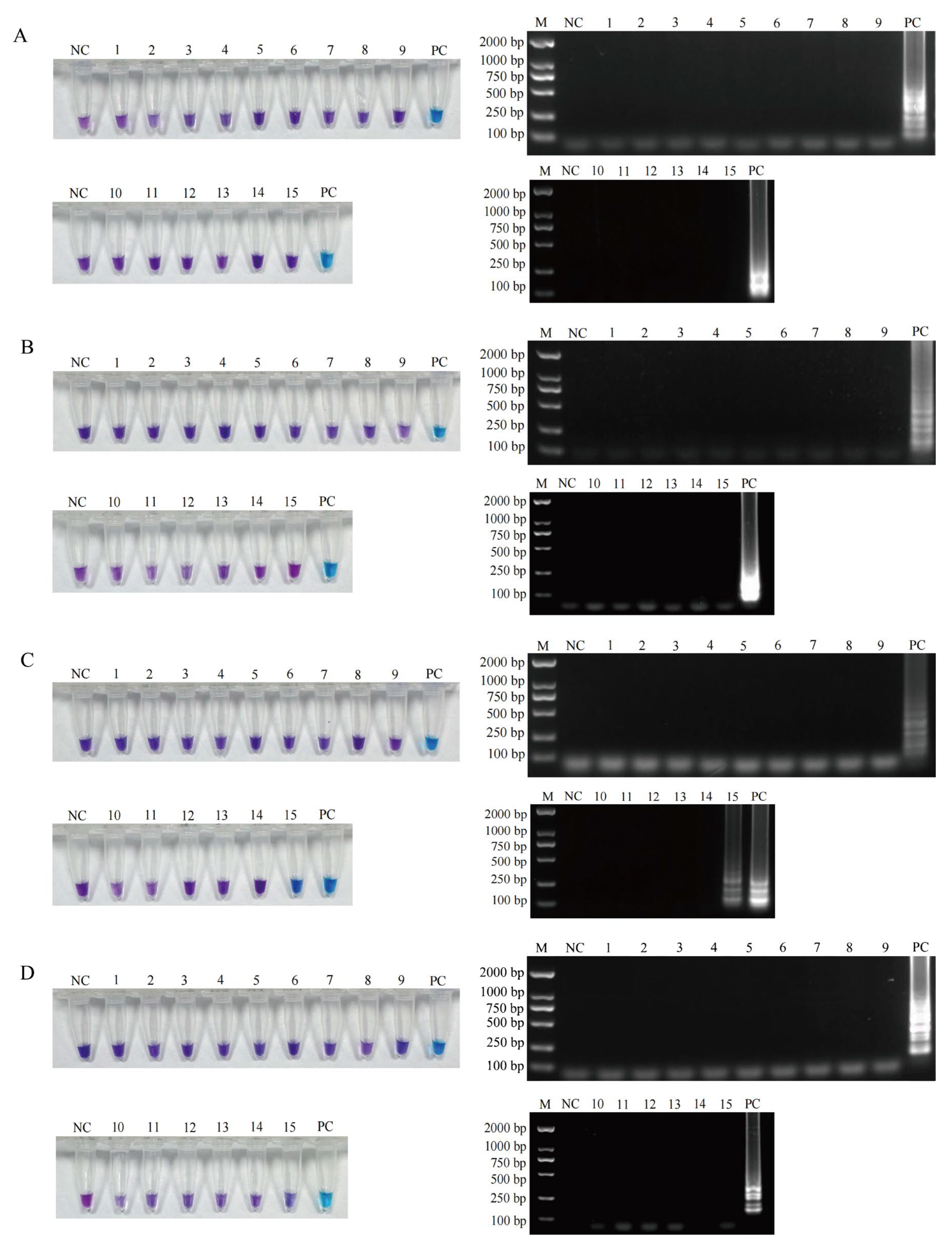 Loop-Mediated Isothermal Amplification for Detecting Four Major Foodborne Pathogens in Meat and ...