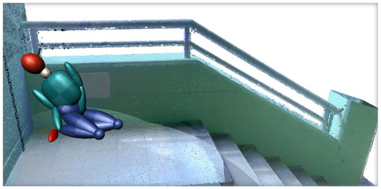 Establishing the Manner of Death: A 3D Reconstruction of a Case of Hanging