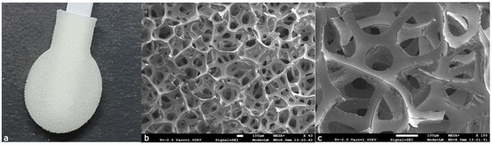 What Are the Limitations and Challenges of Swab-Based DNA Sampling?
