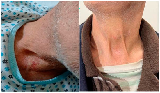 Clinical, Psychiatric and Medicolegal Issues in Non-Fatal Strangulation ...