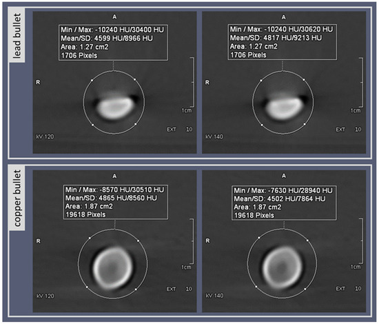 Virtual Bullet Examination: Forensic Insights from CT Imaging in ...