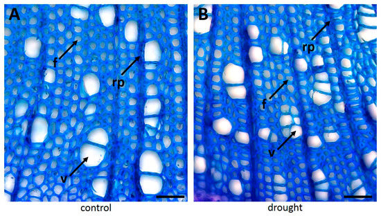 Forests | Free Full-Text | What Makes the Wood? Exploring the Molecular Mechanisms of Xylem ...