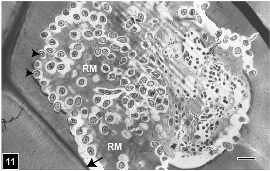 Advances in Understanding Microbial Deterioration of Buried and ...