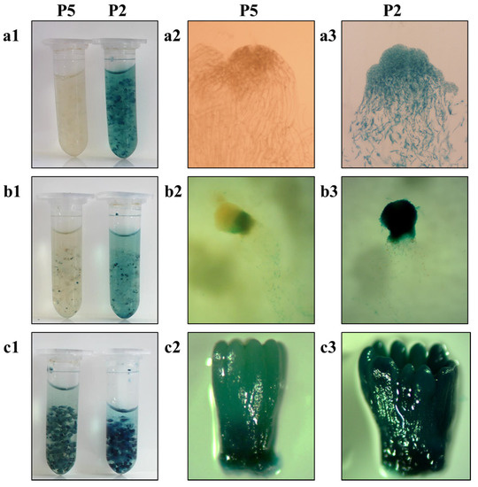 Agrobacterium-Mediated Genetic Transformation of Larix kaempferi (Lamb ...