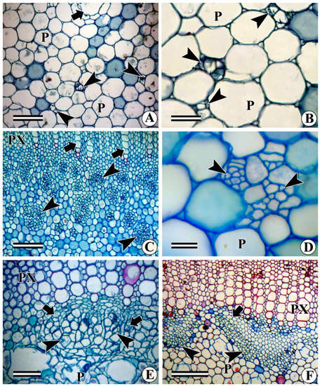 Inter- and Intraxylary Phloem in Vascular Plants: A Review of Subtypes ...