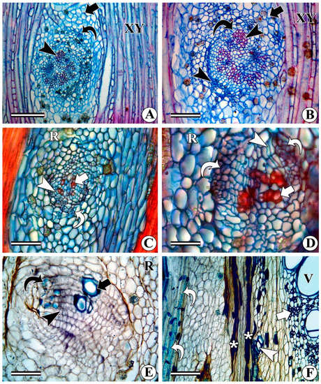 Inter- and Intraxylary Phloem in Vascular Plants: A Review of Subtypes ...