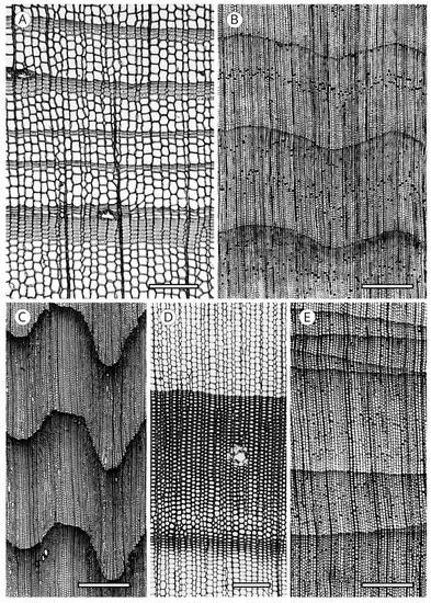 Softwood Anatomy: A Review
