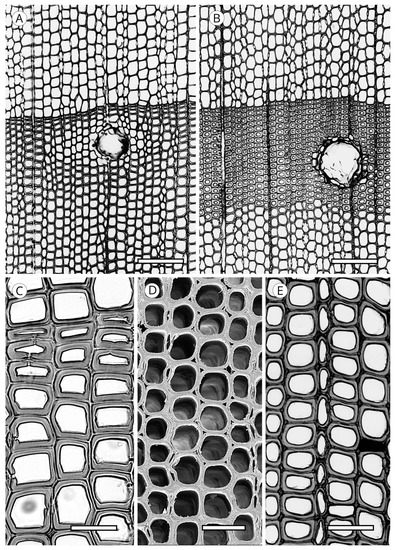 Softwood Anatomy: A Review