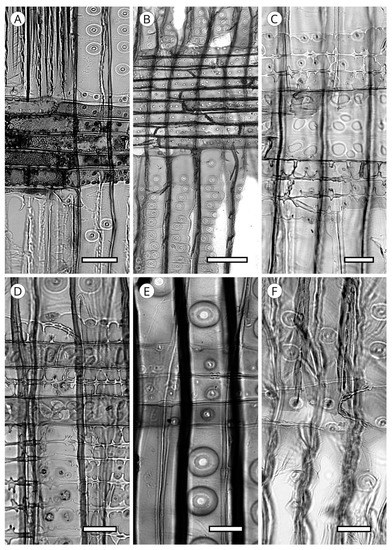 Softwood Anatomy: A Review