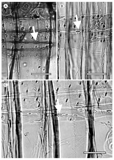Softwood Anatomy: A Review