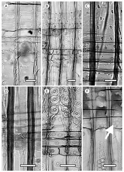 Softwood Anatomy: A Review