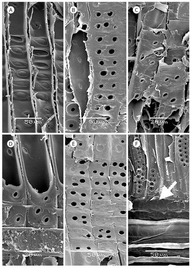 Softwood Anatomy: A Review