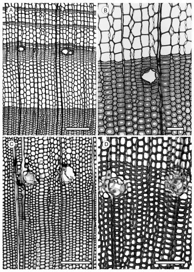 Softwood Anatomy: A Review
