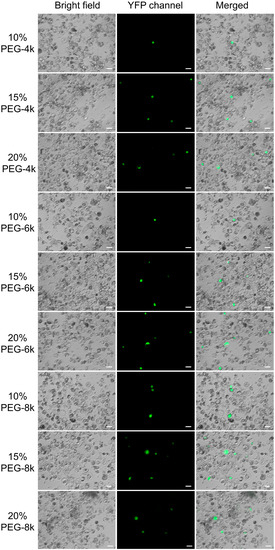 Establishment of PEG-Mediated Transient Gene Expression in Protoplasts ...