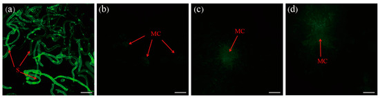 Enhancing the Cryopreservation System of Larch Embryogenic Culture by ...