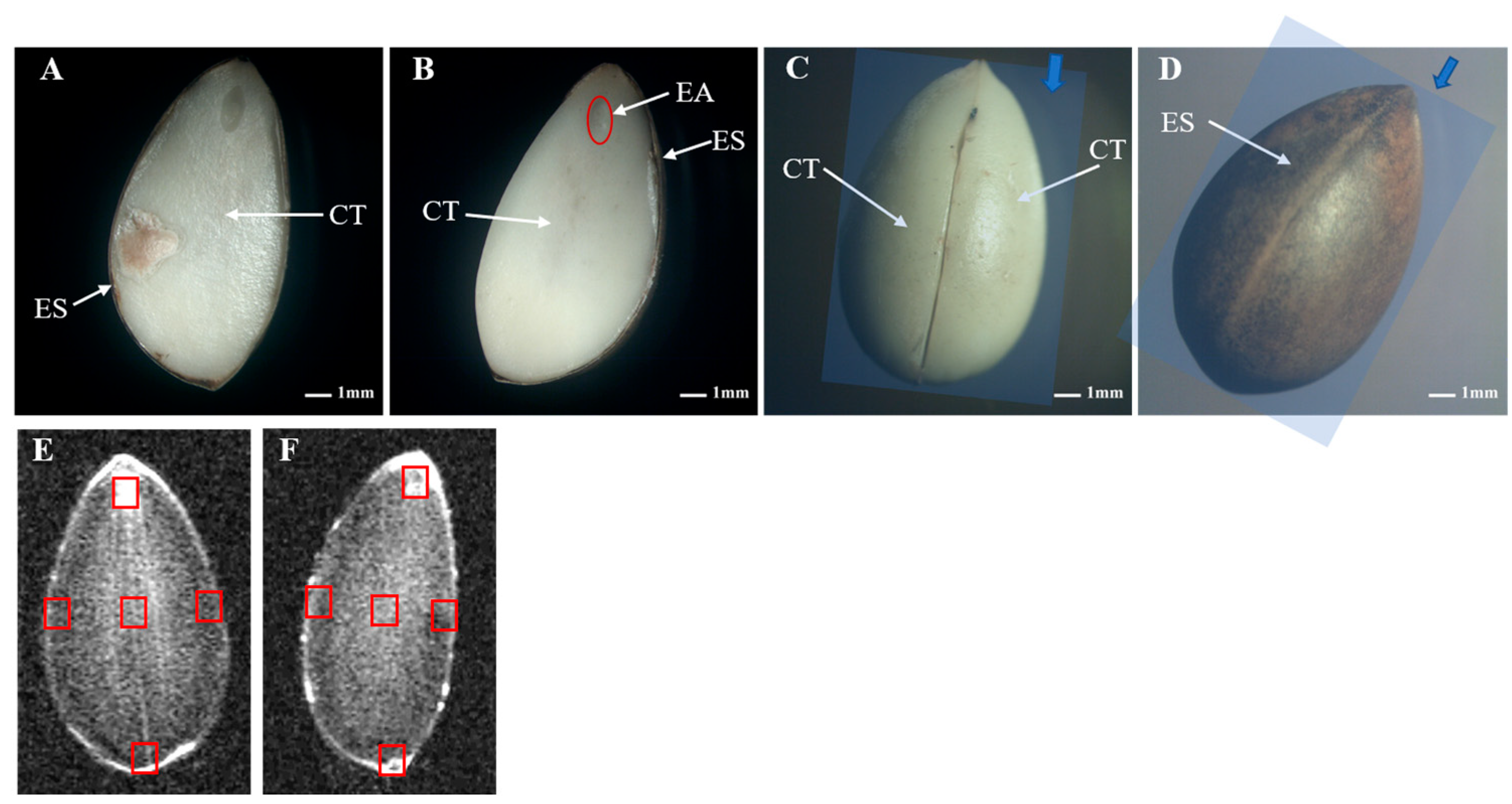 Forests | Free Full-Text | Changes in Water Dynamics and Vigor of ...