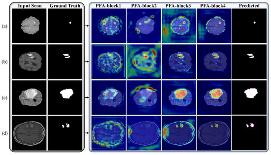 Fractal Fract Free Full Text Estimation Of Fractal Dimension And Segmentation Of Brain Tumor