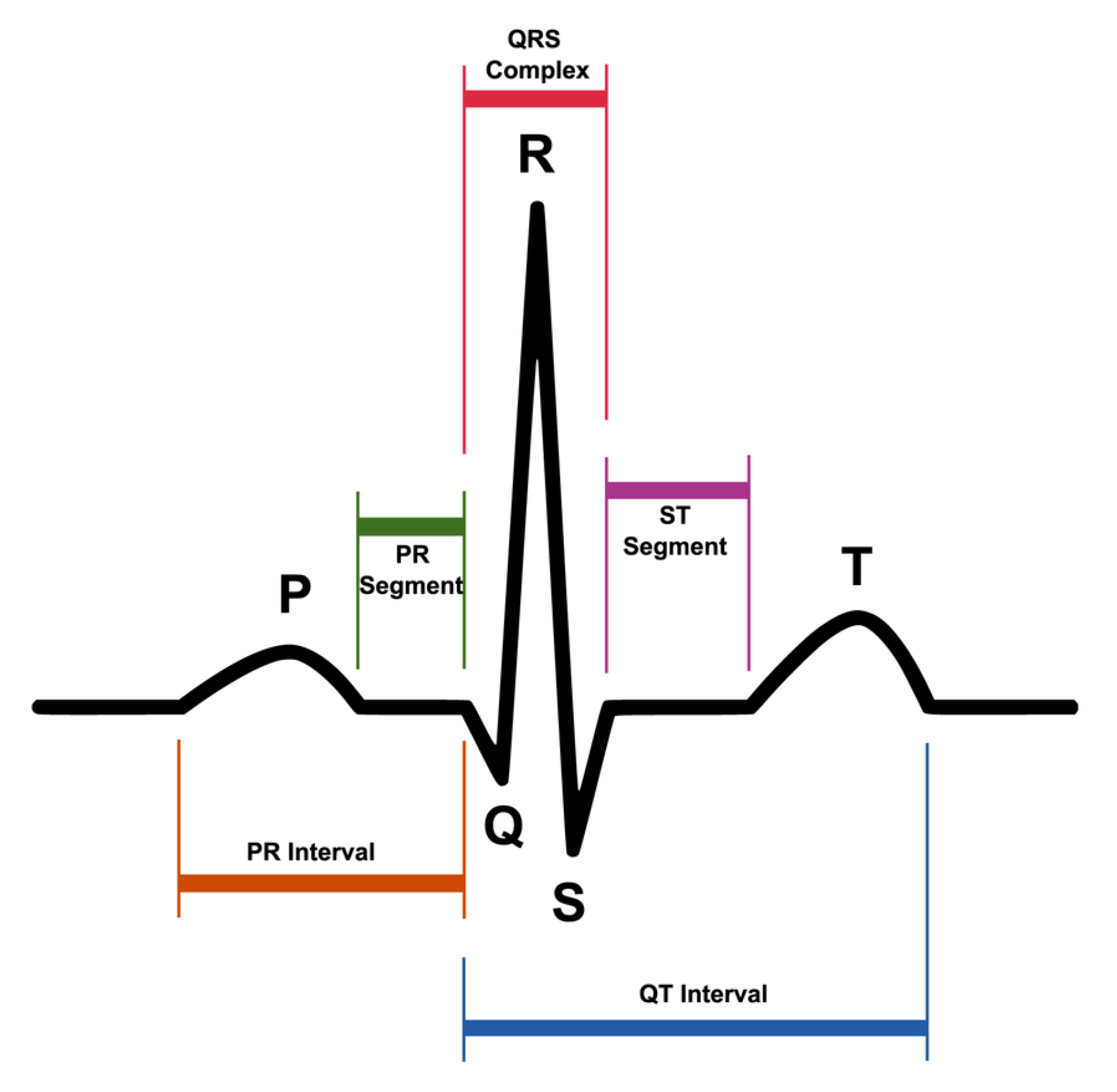 Future Internet | Free Full-Text | Heart DT: Monitoring and Preventing Cardiac Pathologies Using ...