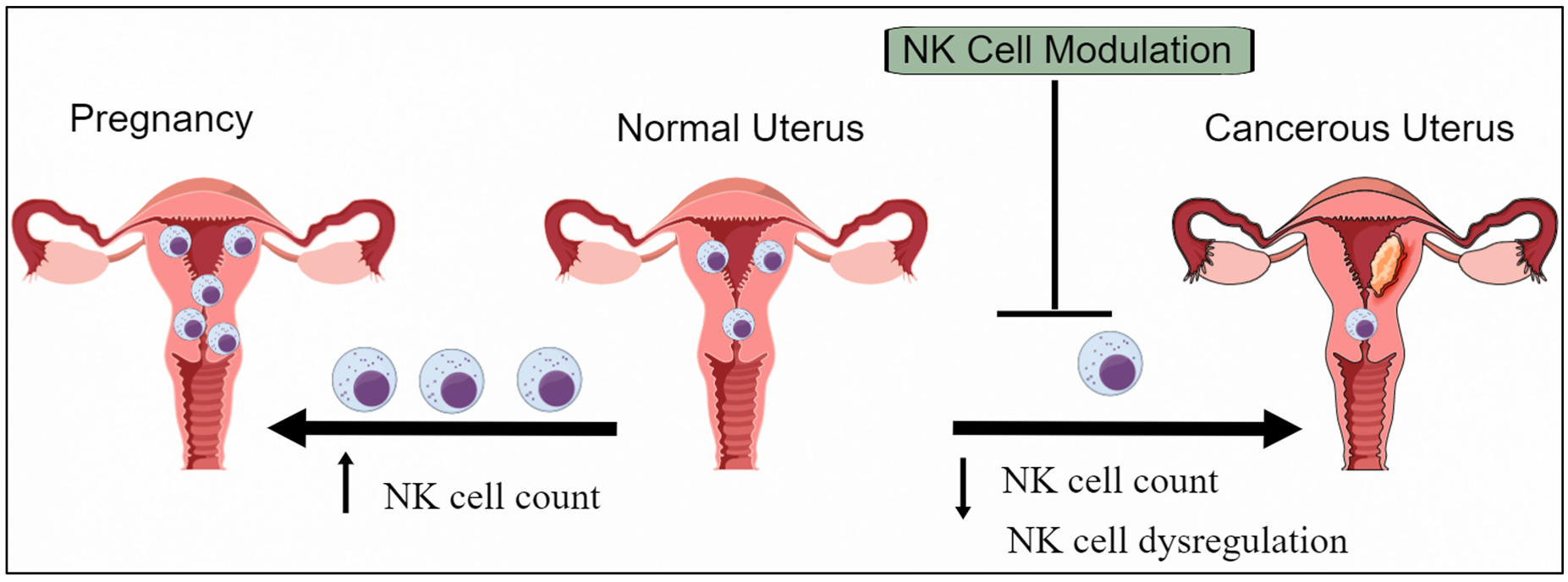 Future Pharmacology | Free Full-Text | Chasing Uterine Cancer with NK ...