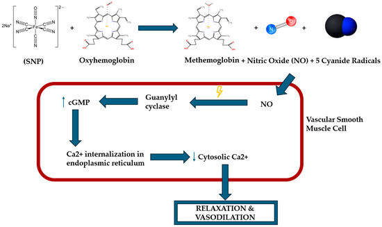 Sodium Nitroprusside: The Forgotten Vasodilator? A Brief Guide for ...
