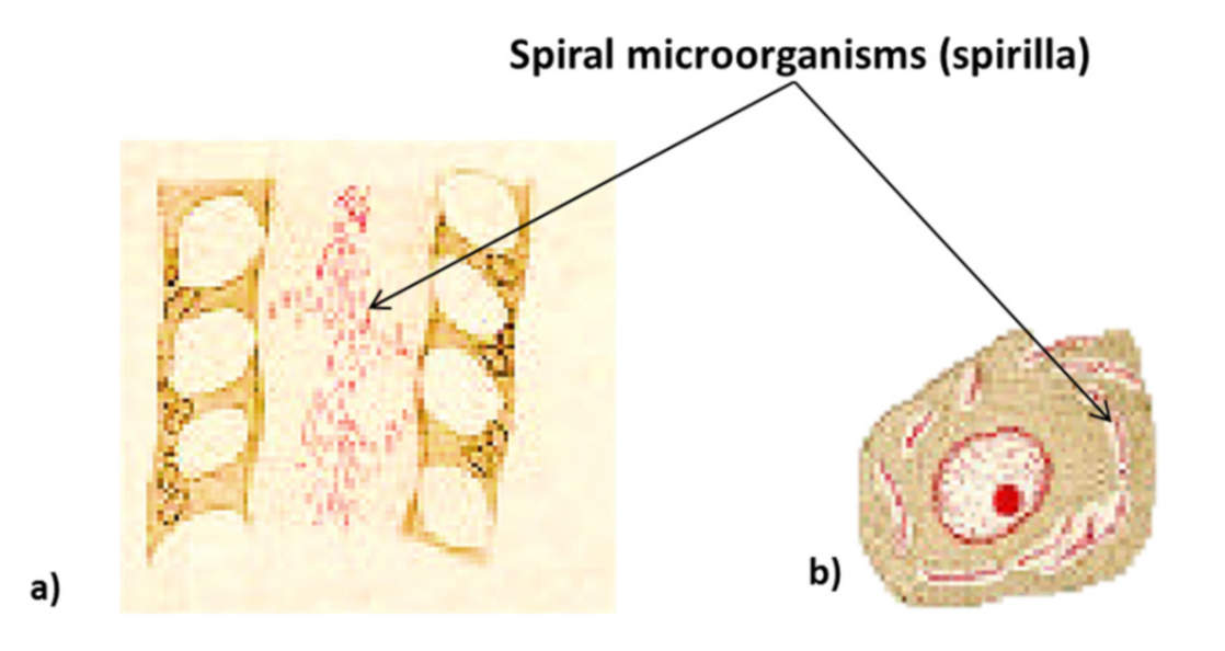 40 Years of Helicobacter pylori: A Revolution in Biomedical Thought