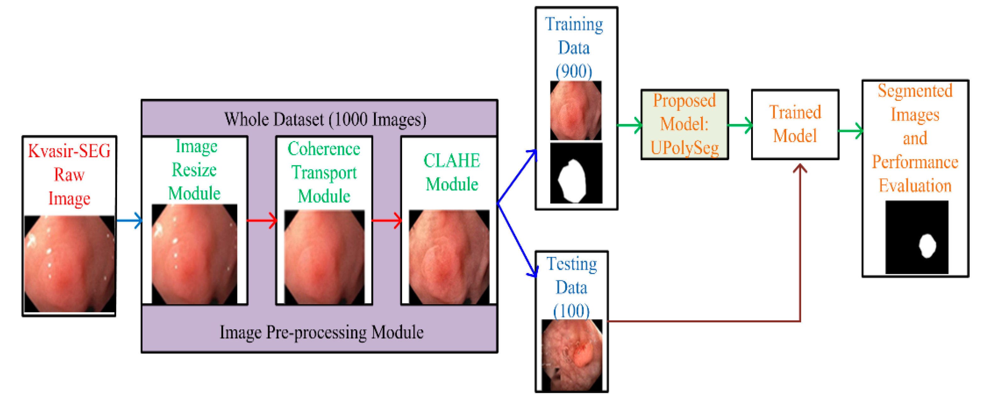 UPolySeg: A U-Net-Based Polyp Segmentation Network Using Colonoscopy Images