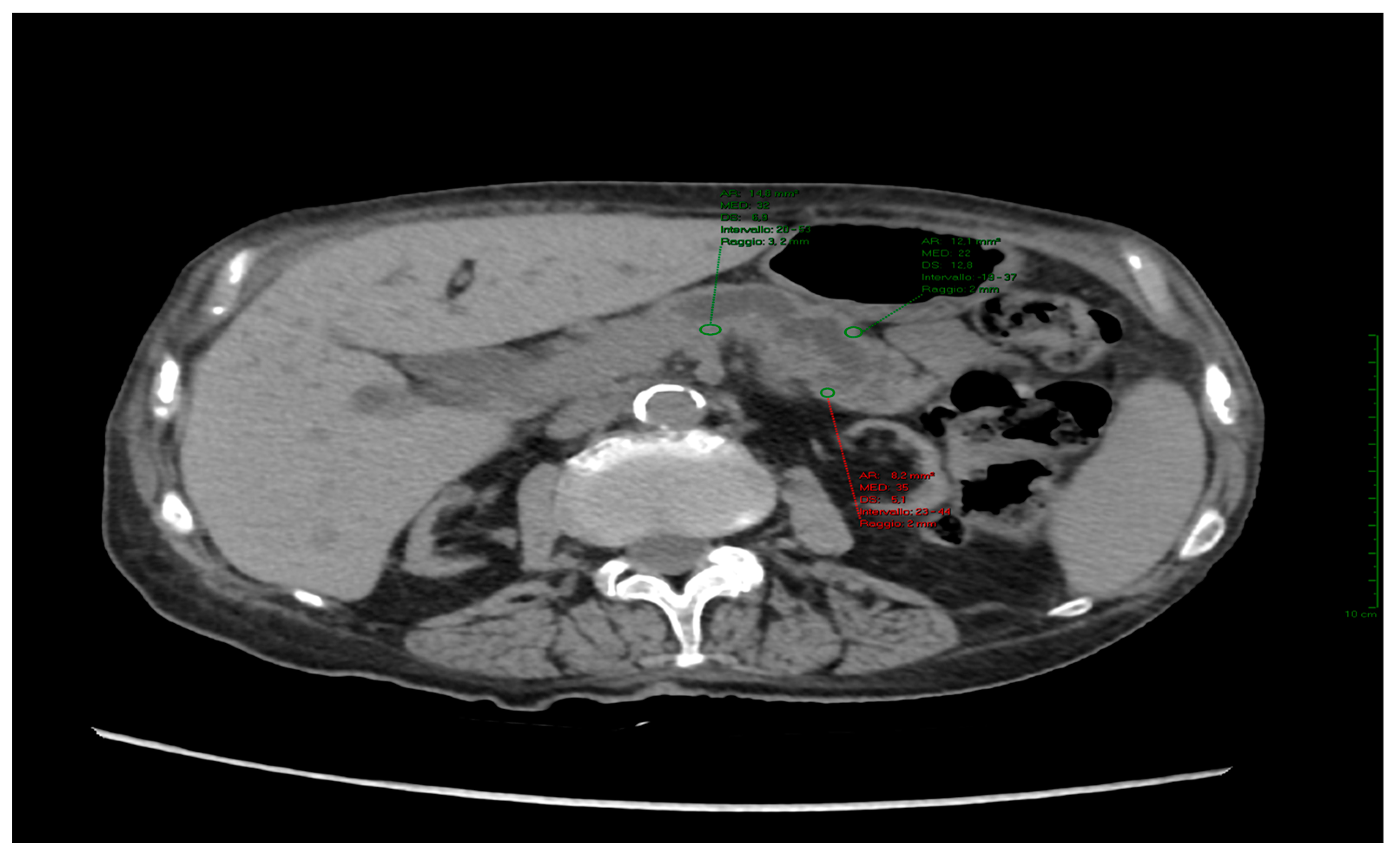 Gastroenterology Insights | Free Full-Text | Computed Tomography ...