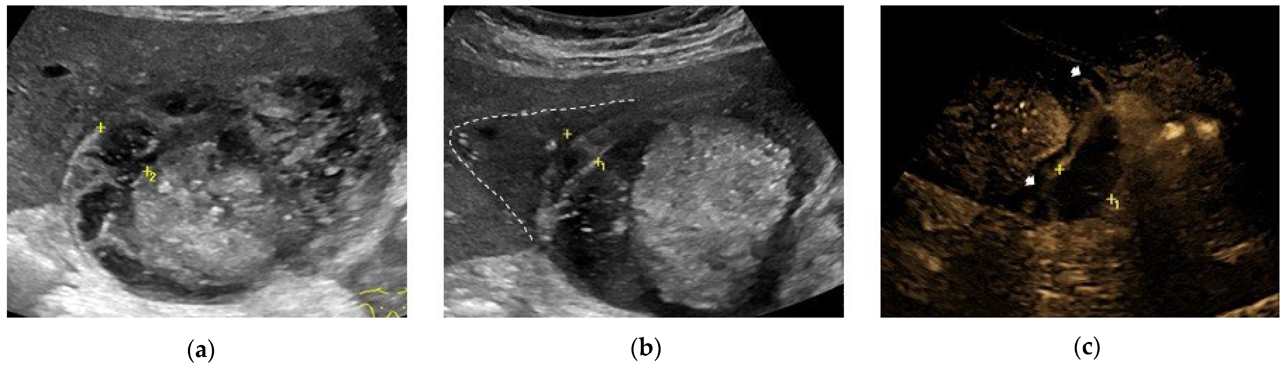Gastroenterology Insights | Free Full-Text | New Developments in the ...