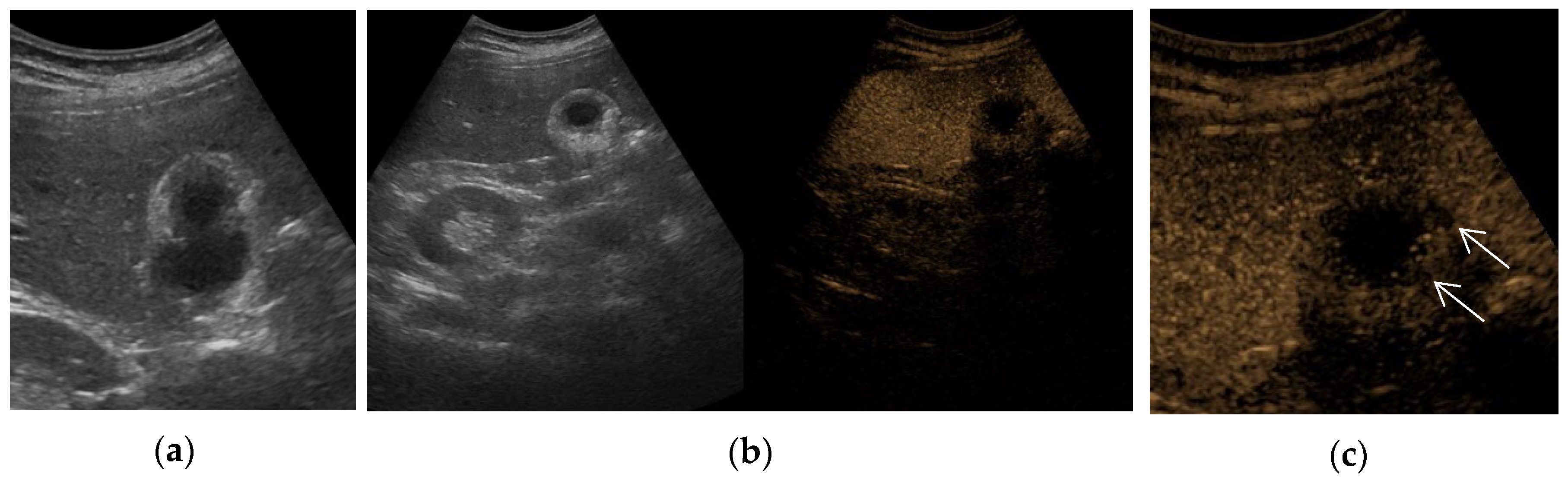 Gastroenterology Insights | Free Full-Text | New Developments in the ...