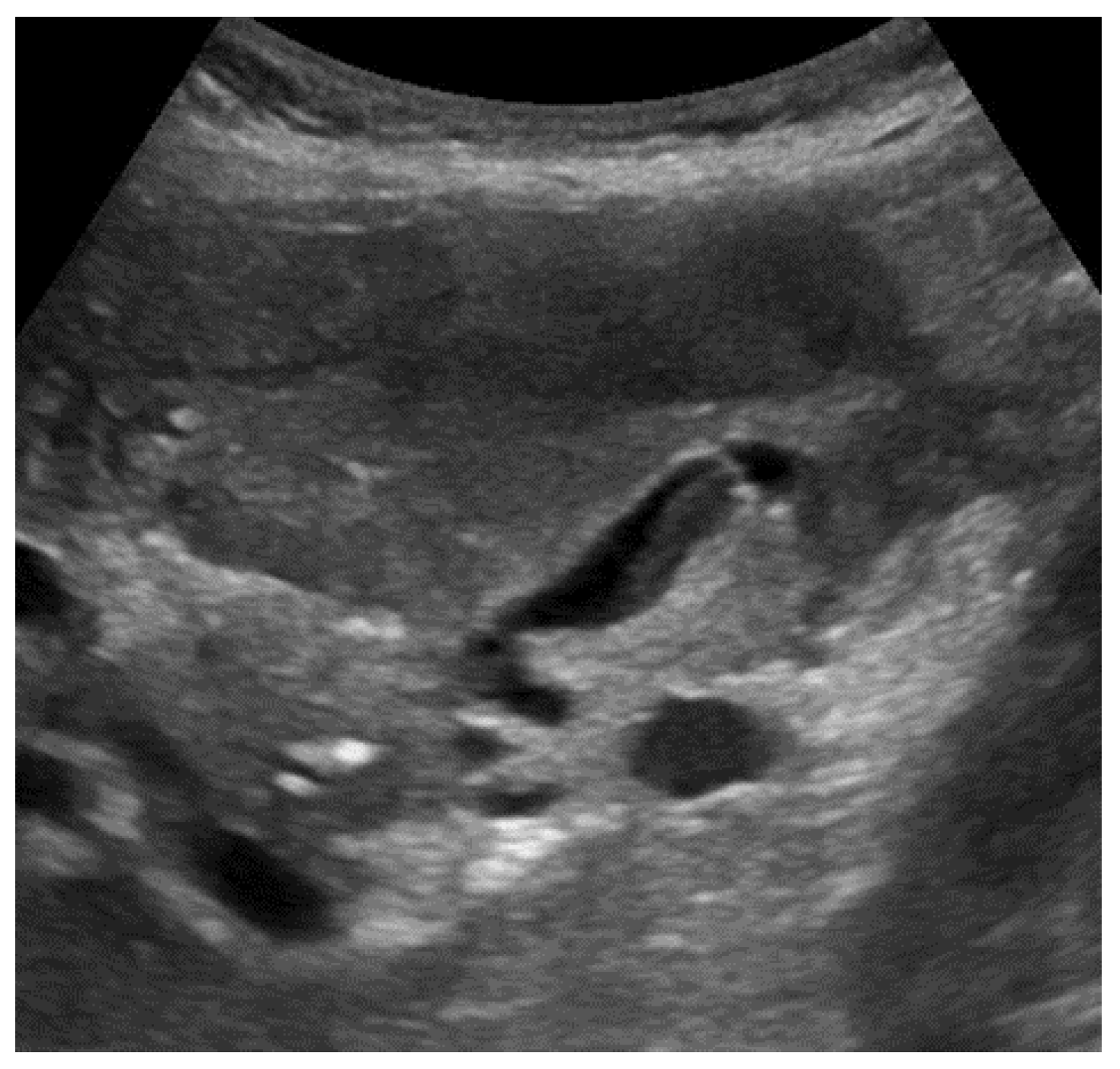 Gastroenterology Insights | Free Full-Text | New Developments in the ...