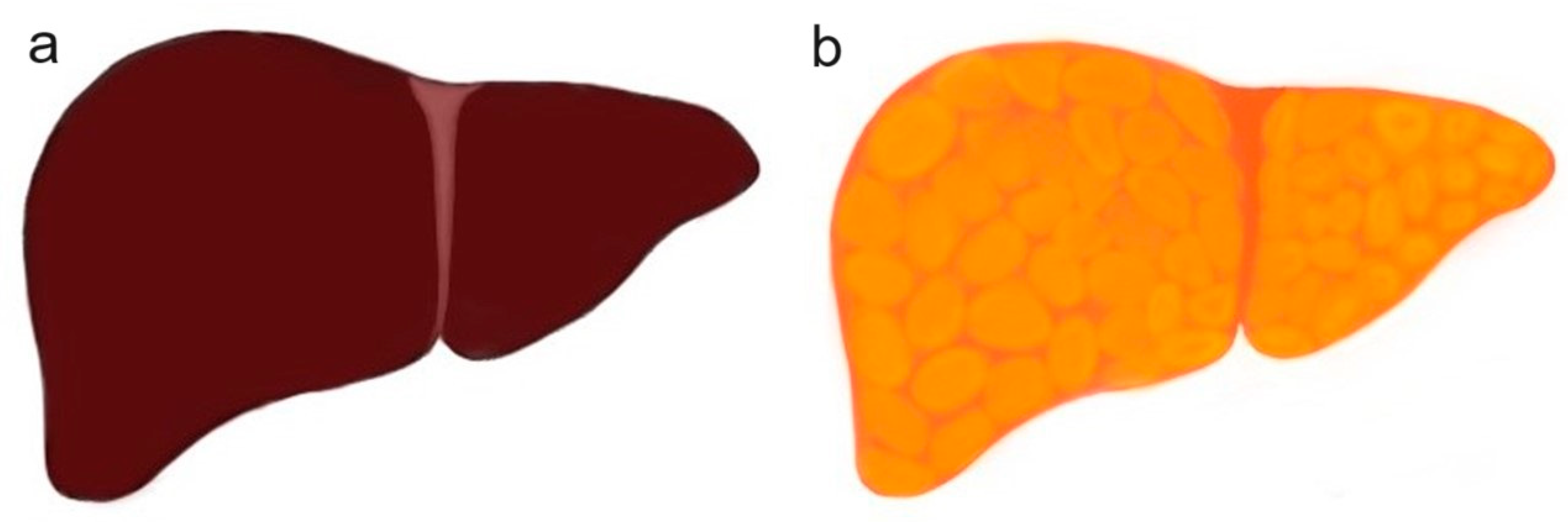 Gastroenterology Insights | Free Full-Text | Grading of Fatty Liver ...