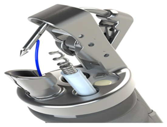 Endoscopic Management of Gastric Disruptions