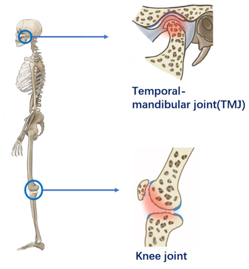 Gels | Free Full-Text | Effect of Micro-/Nanoparticle Hybrid Hydrogel ...