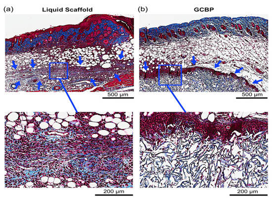 Evaluating the Biocompatibility of an Injectable Wound Matrix in a ...