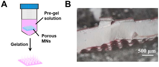 A Porous Reservoir-Backed Boronate Gel Microneedle for Efficient Skin ...