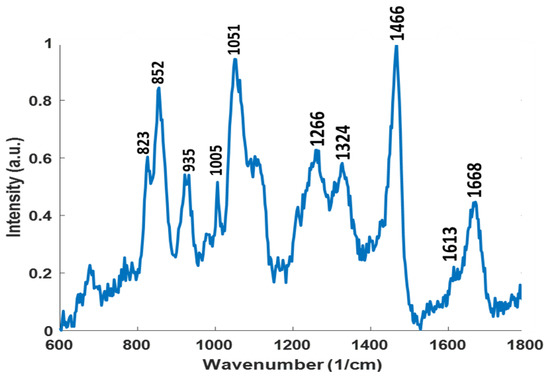 Gene Expression and Characterization of Iturin A Lipopeptide ...
