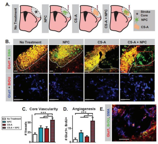 Advancements in Hydrogel Application for Ischemic Stroke Therapy