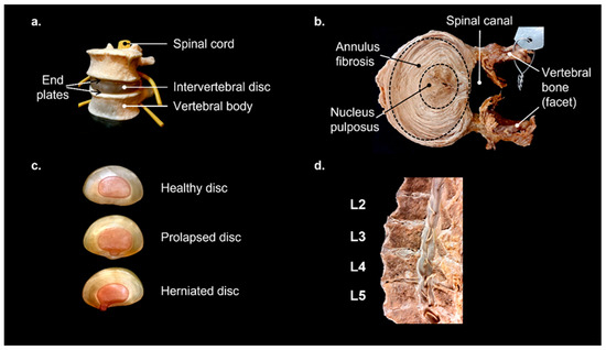 Intervertebral Disc Tissue Engineering Using Additive Manufacturing