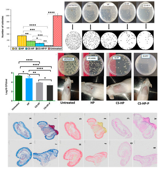 Update on Chitosan-Based Hydrogels: Preparation, Characterization, and Its Antimicrobial and ...