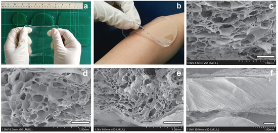 Antibacterial Hydrogel Sheet Dressings Composed of Poly(vinyl alcohol ...