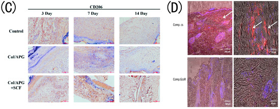 Gels | Free Full-Text | Application of Collagen-Based Hydrogel in Skin ...