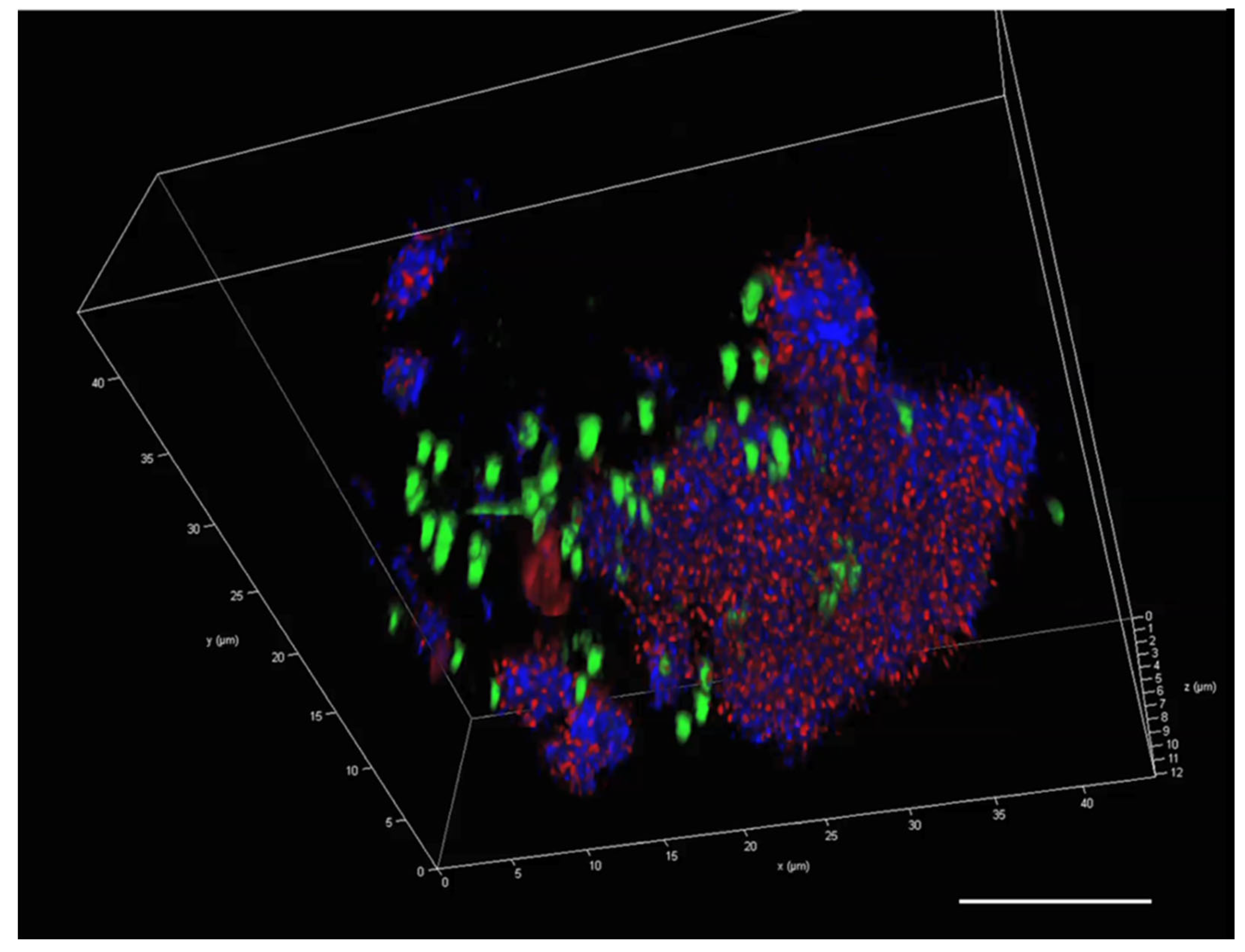 Isolation and Staining Reveal the Presence of Extracellular DNA in ...