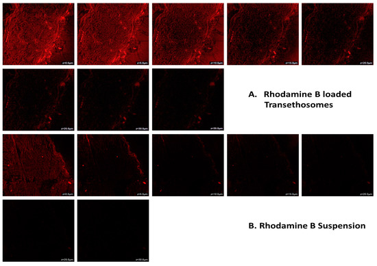 Formulation Development, Optimization by Box–Behnken Design, and In ...