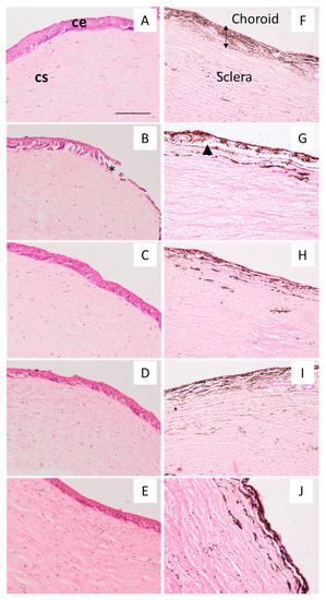 Caspofungin-Loaded Formulations for Treating Ocular Infections Caused ...