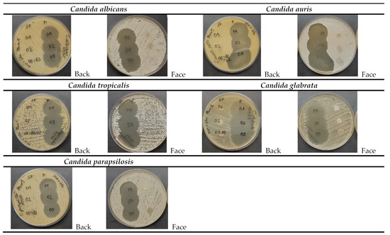 Caspofungin-Loaded Formulations for Treating Ocular Infections Caused ...