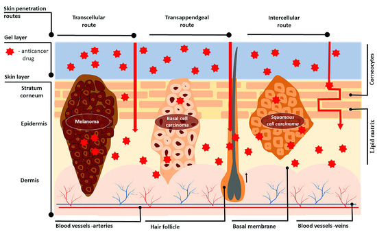Gel Formulations for Topical Treatment of Skin Cancer: A Review