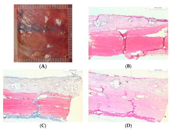 A Novel Bio-Adhesive Mesh System for Medical Implant Applications: In ...